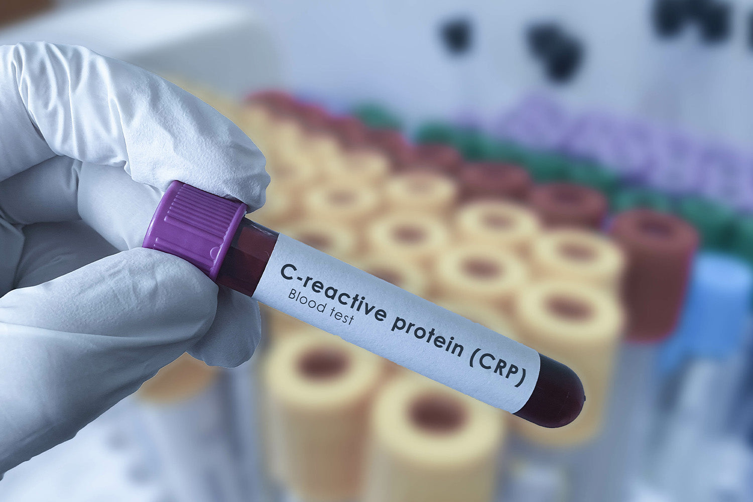 How To Reduce CRP Level: Seven Tips – fatty15